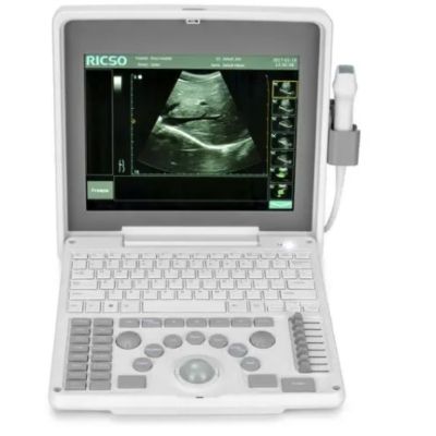 Gynéco-obstétrique Archives - MedicalExpo Africa