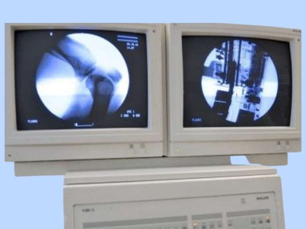 AMPLIFICATEUR DE BRILLANCE PHILIPS BV 29, DOUBLE ECRAN, MEMOIRE D'IMAGE ...