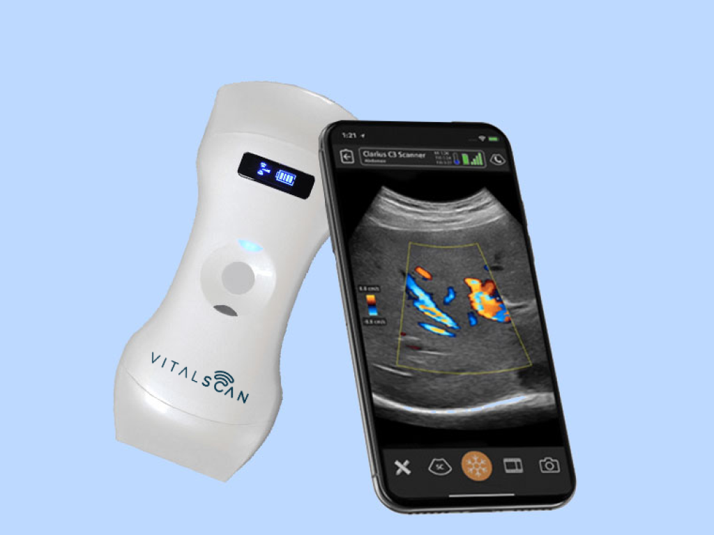 Mini échographe Portable Sans Fil - VitalScan X5 Dual Head ...